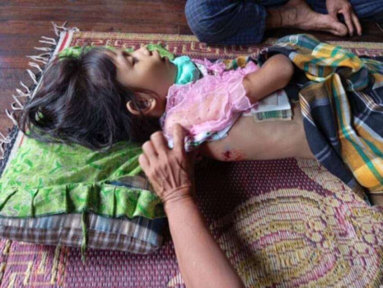 ကလေးများ အပါအဝင် ၄ ဦးသေဆုံးပြီး ၃၅ ဦးဒဏ်ရာရရှိသော ပန်ရပ် ကျေးရွာ နေအိမ်စာသင် ကျောင်း လေယာဉ်ဖြင့